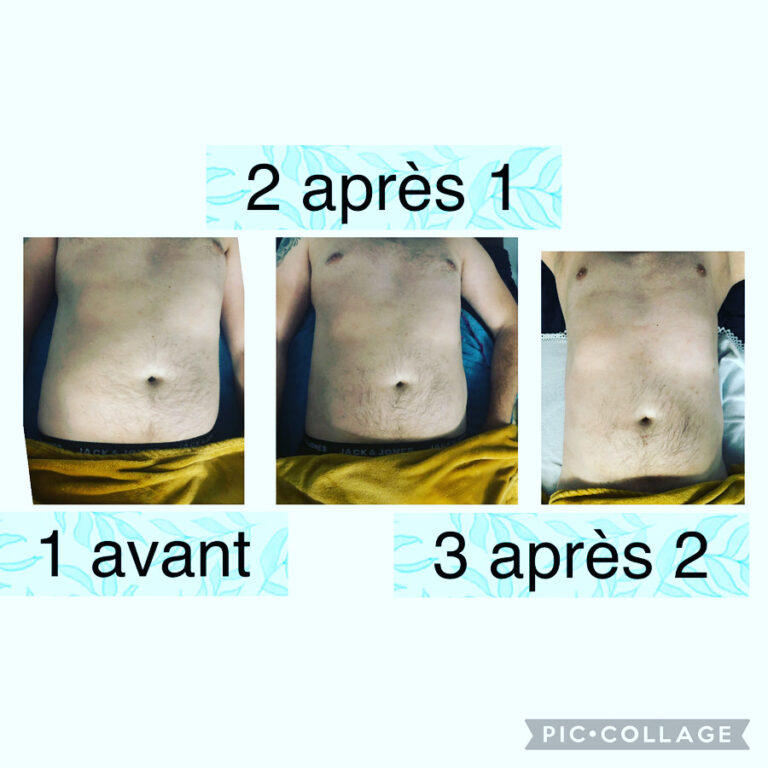 Objectif bien-être - Drainage lymphatique brésilien